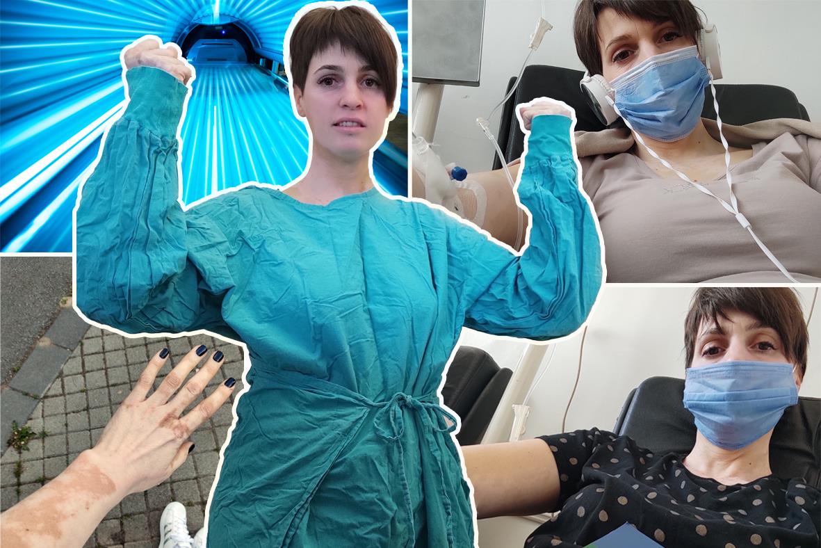 Katarina Čočović o borbi sa melanomom | Zdravlje Kurir