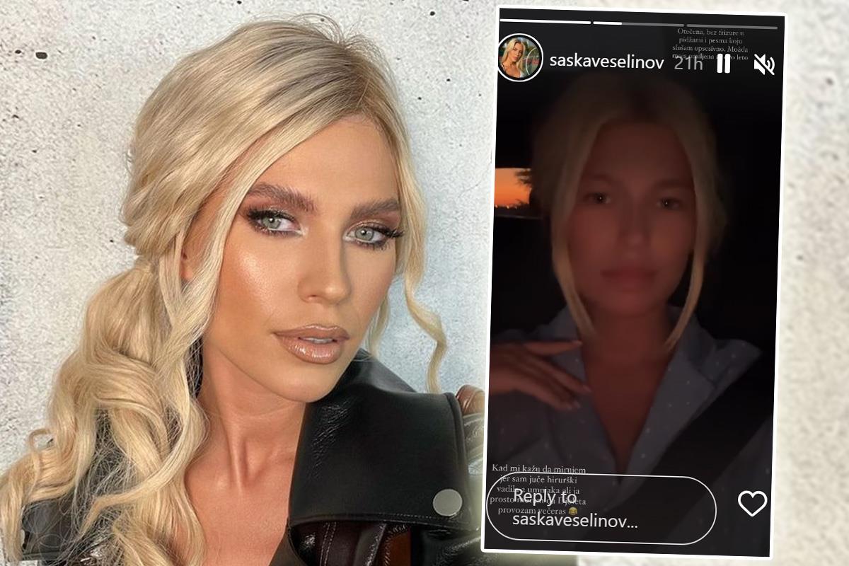 Saška Veselinov pokazala kako izgleda nakon intervencije | Kurir