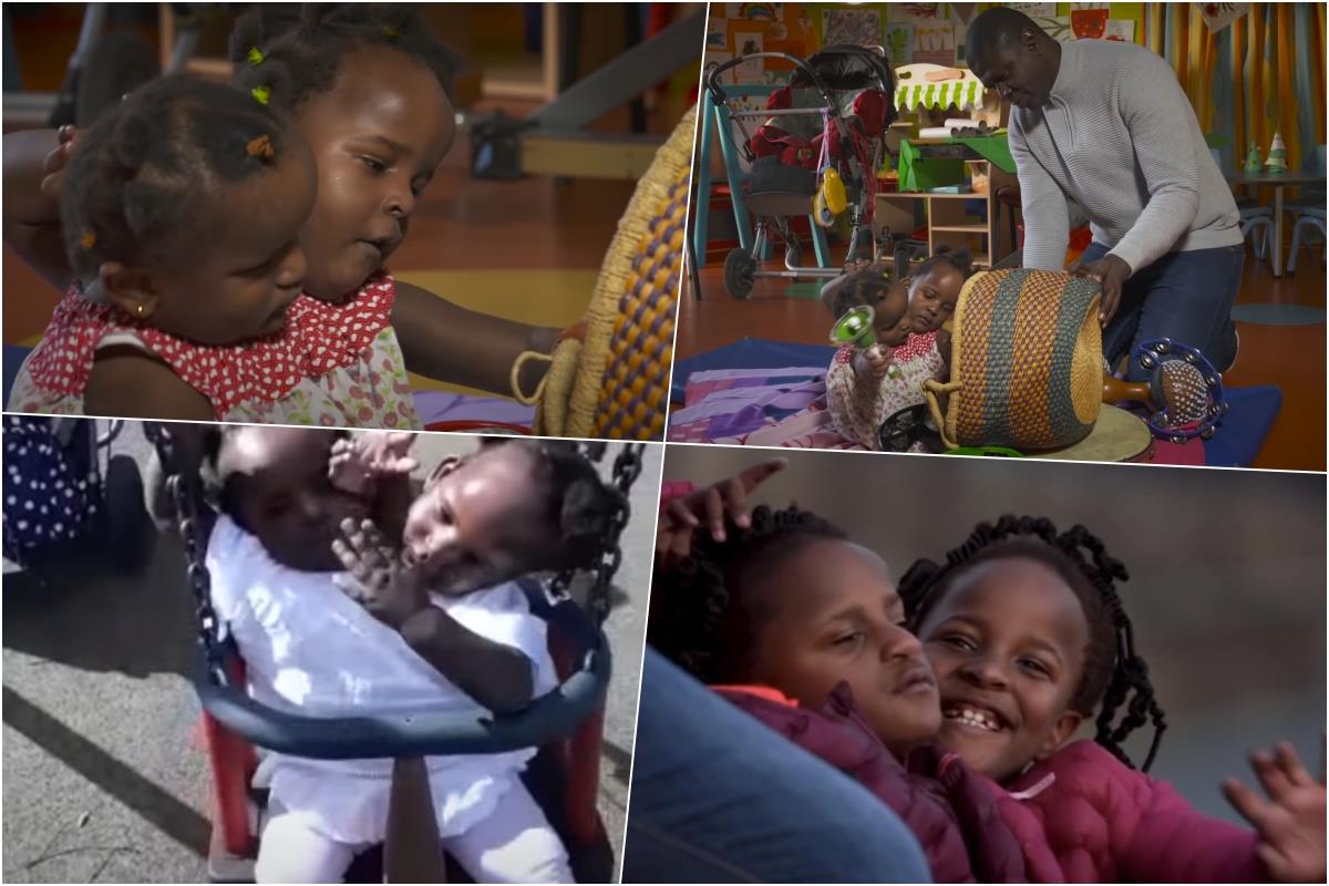 Sijamske bliznakinje Merjem i Ndeje proslavile sedmi rođendan i idu u ...