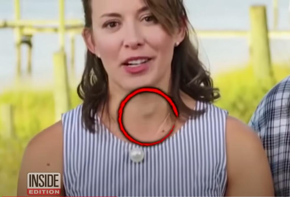 Lekar uživo u emisiji kontaktirao ženu zbog promene na vratu | Kurir