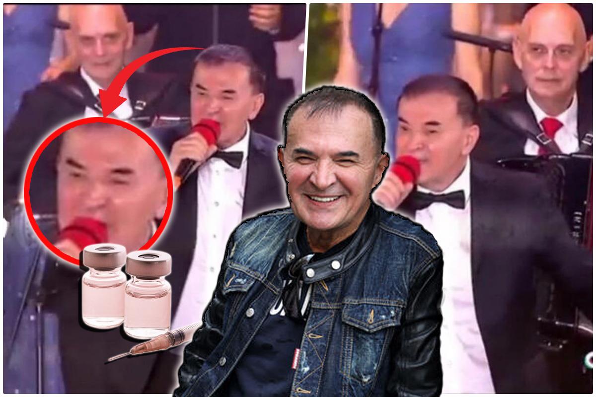 Mitar Mirić se izobličio od botoksa | Kurir