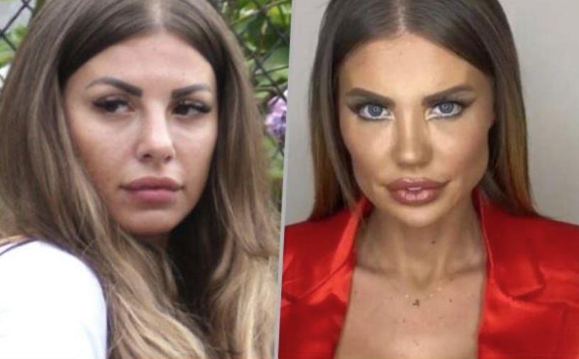 Dragana Mitar više ne izgleda ovako: Samo na licu imala više od 10 ...