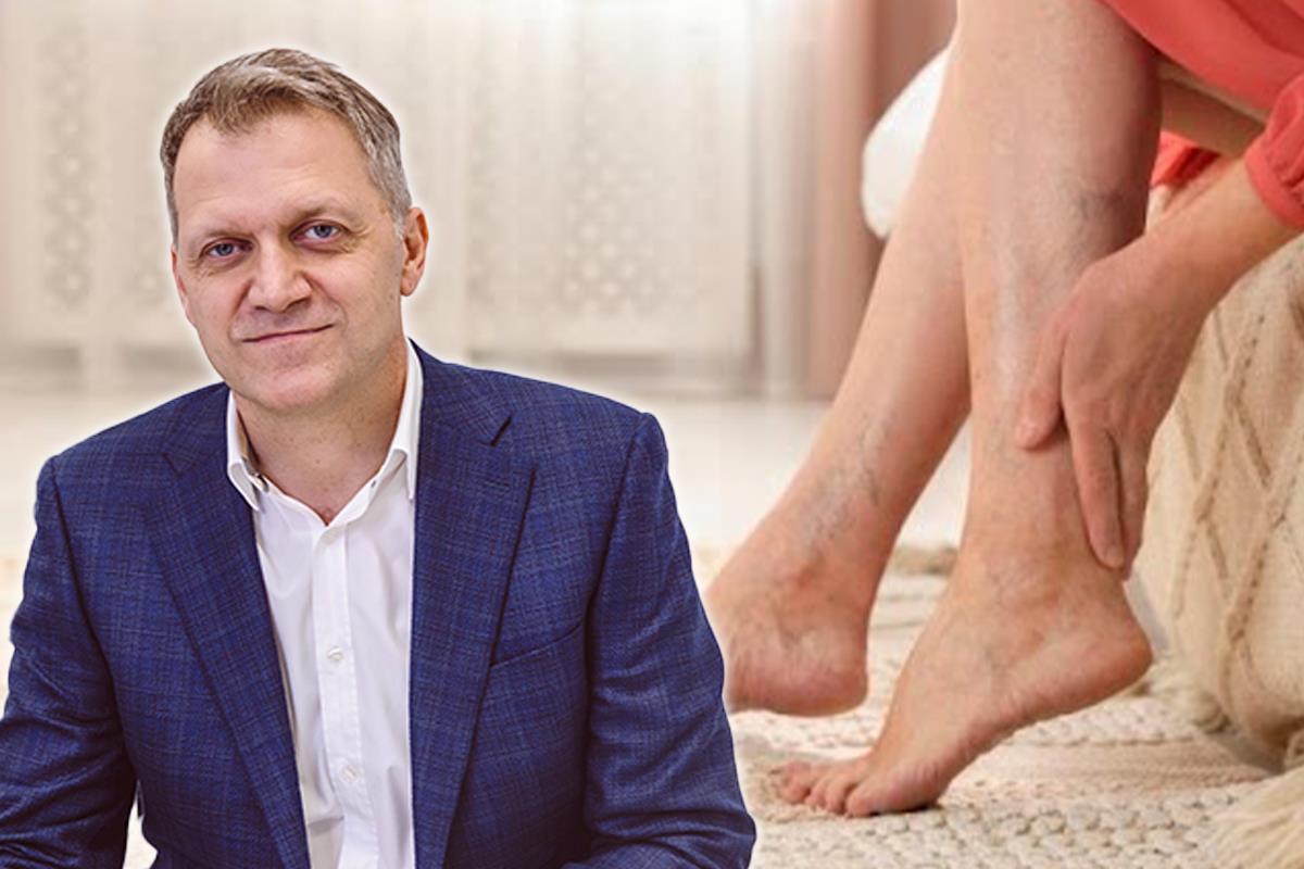 Kako razlikovati venske i arterijske bolesti otkriva vaskularni hirurg ...