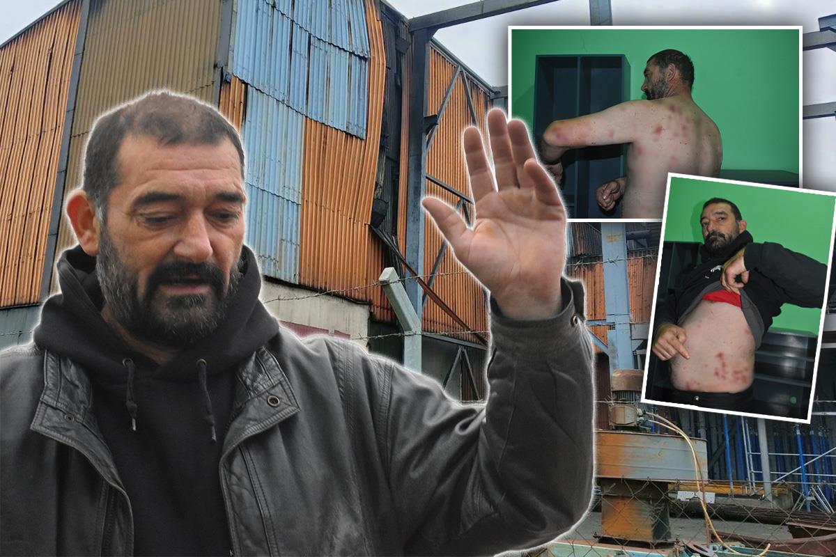 Ispovest povređenog radnika u livnici kod Čoke, dvojica podlegla povredama | Kurir