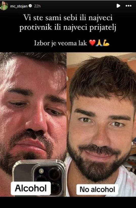 Mc Stojan pokazao šta mu je alkohol učinio od lica! Reper objavio kožu "pre i posle": Dugo se ...