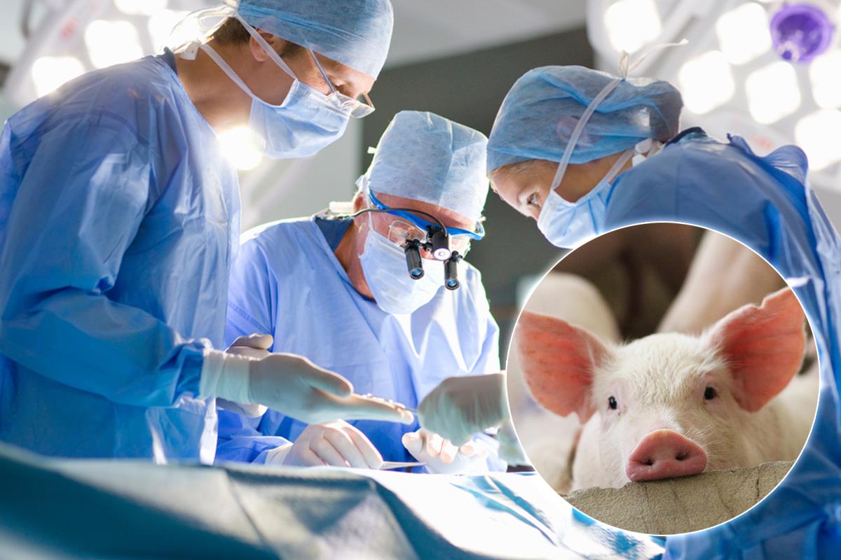 Pacijent živeo 171 dan nakon transplantacije svinjske jetre | Zdravlje Kurir