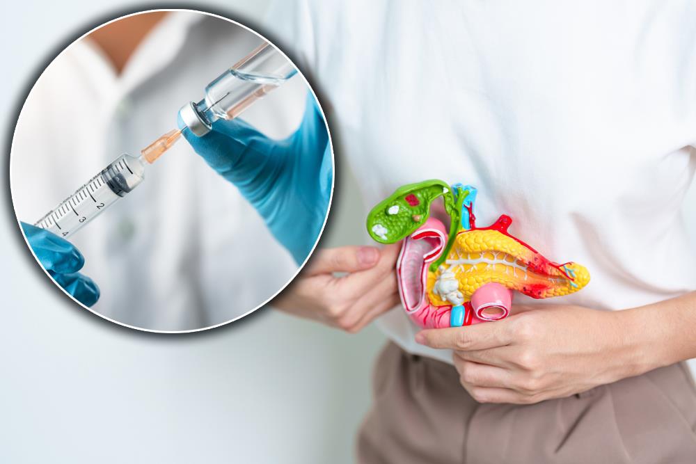 Razvijena nova imunoterapija za rak pankreasa | Zdravlje Kurir