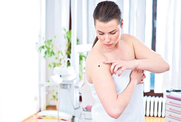 Svrab i bol upućuju na rak kože? | Kurir