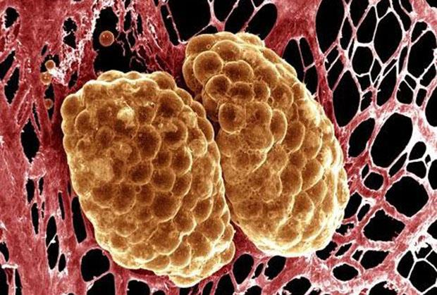Gde nestaje masnoća dok mršavimo? | Kurir
