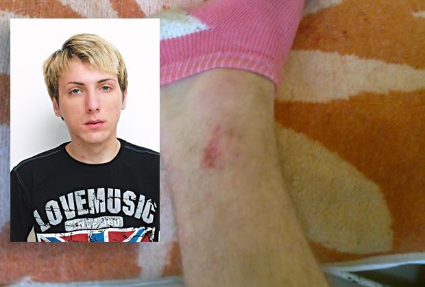 STEFAN RADOVIĆ: Na psihijatriji me tukao medicinski tehničar | Kurir
