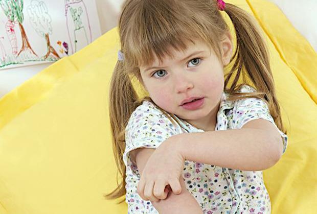 Hitna stanja: Ubod komarca može biti opasan po dete | Kurir