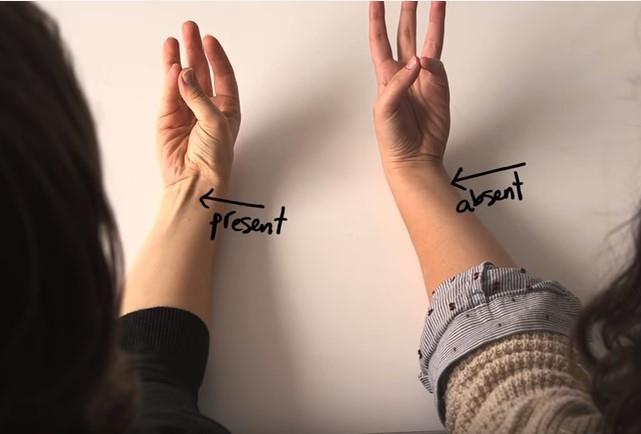 (VIDEO) Većina ljudi nema ovaj mišić na ruci, a evo i zašto | Kurir