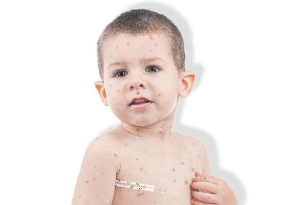 OPASNO! MORBILE SE ŠIRE SRBIJOM: Beograd na pragu epidemije! | Kurir